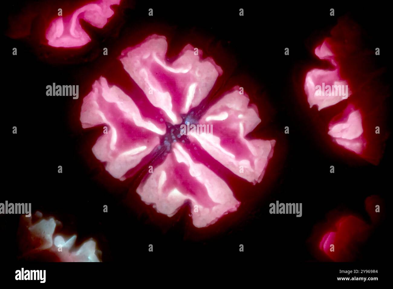 Fluorescence interference contrast (FLIC) light micrograph of ...