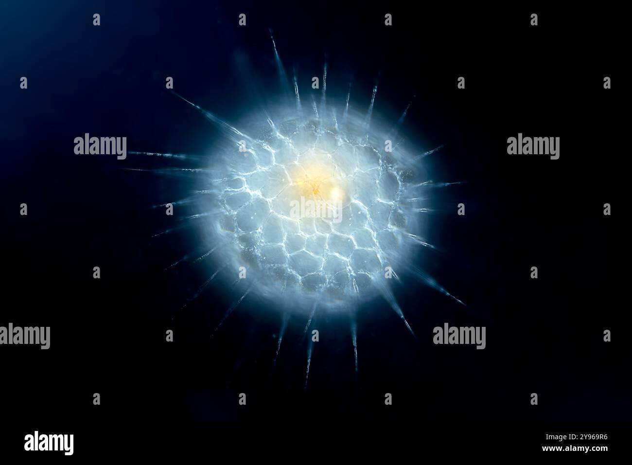 Differential interference contrast (DIC) light micrograph of a Heliozoa ...