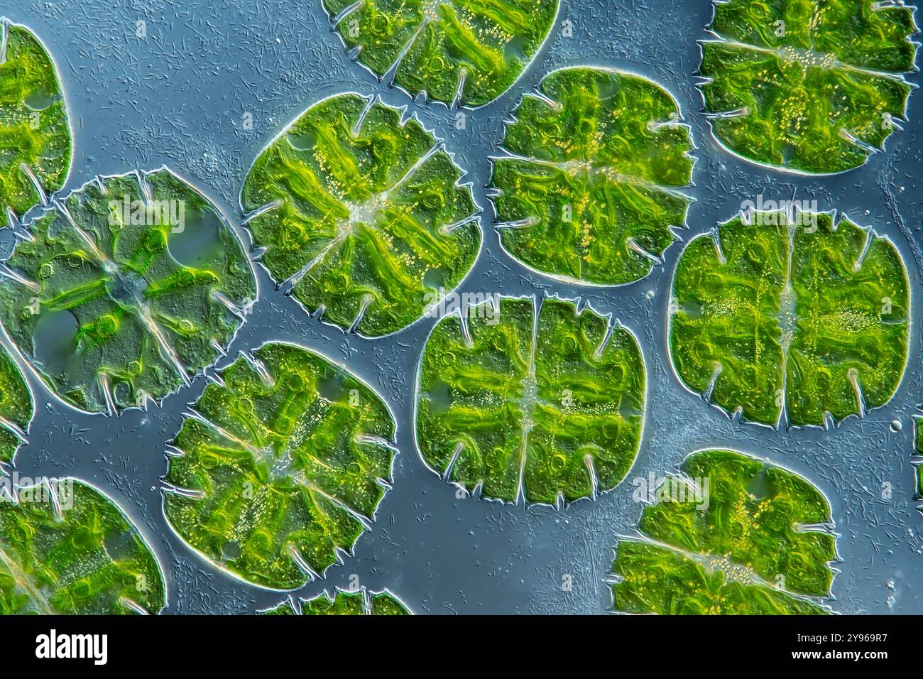 Differential interference contrast (DIC) light micrograph of ...