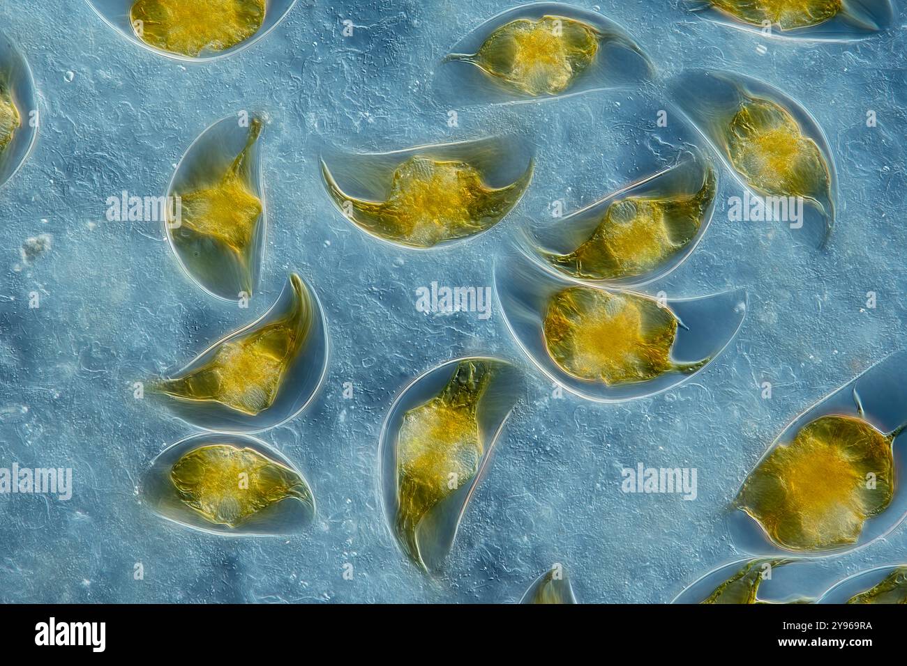 Differential interference contrast (DIC) light micrograph of Pyrocystis ...