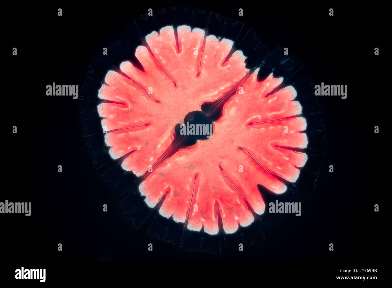 Fluorescence interference contrast (FLIC) light micrograph of ...