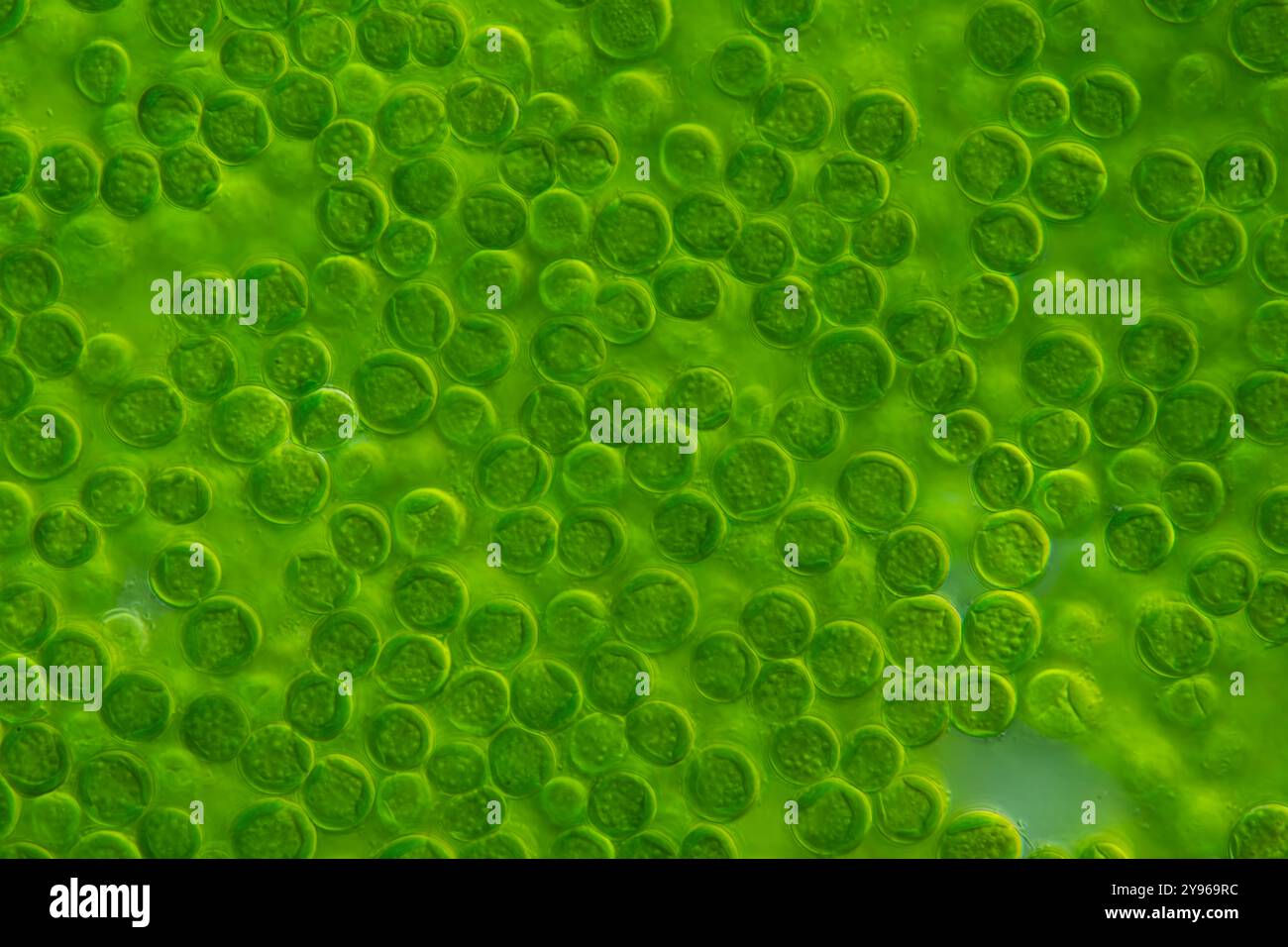 Differential interference contrast (DIC) light micrograph of ...