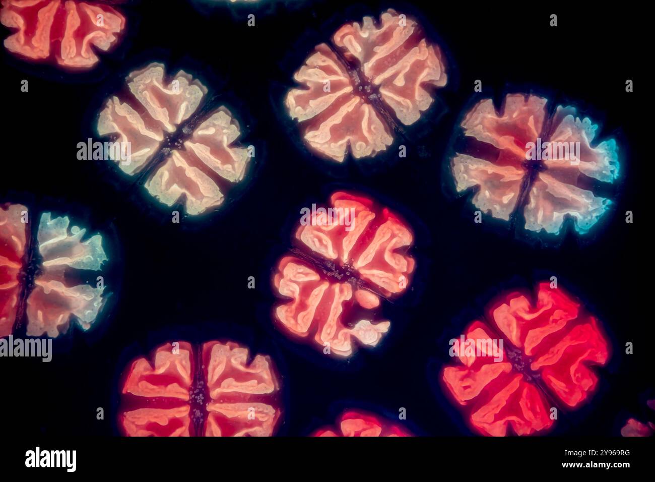 Fluorescence interference contrast (FLIC) light micrograph of ...