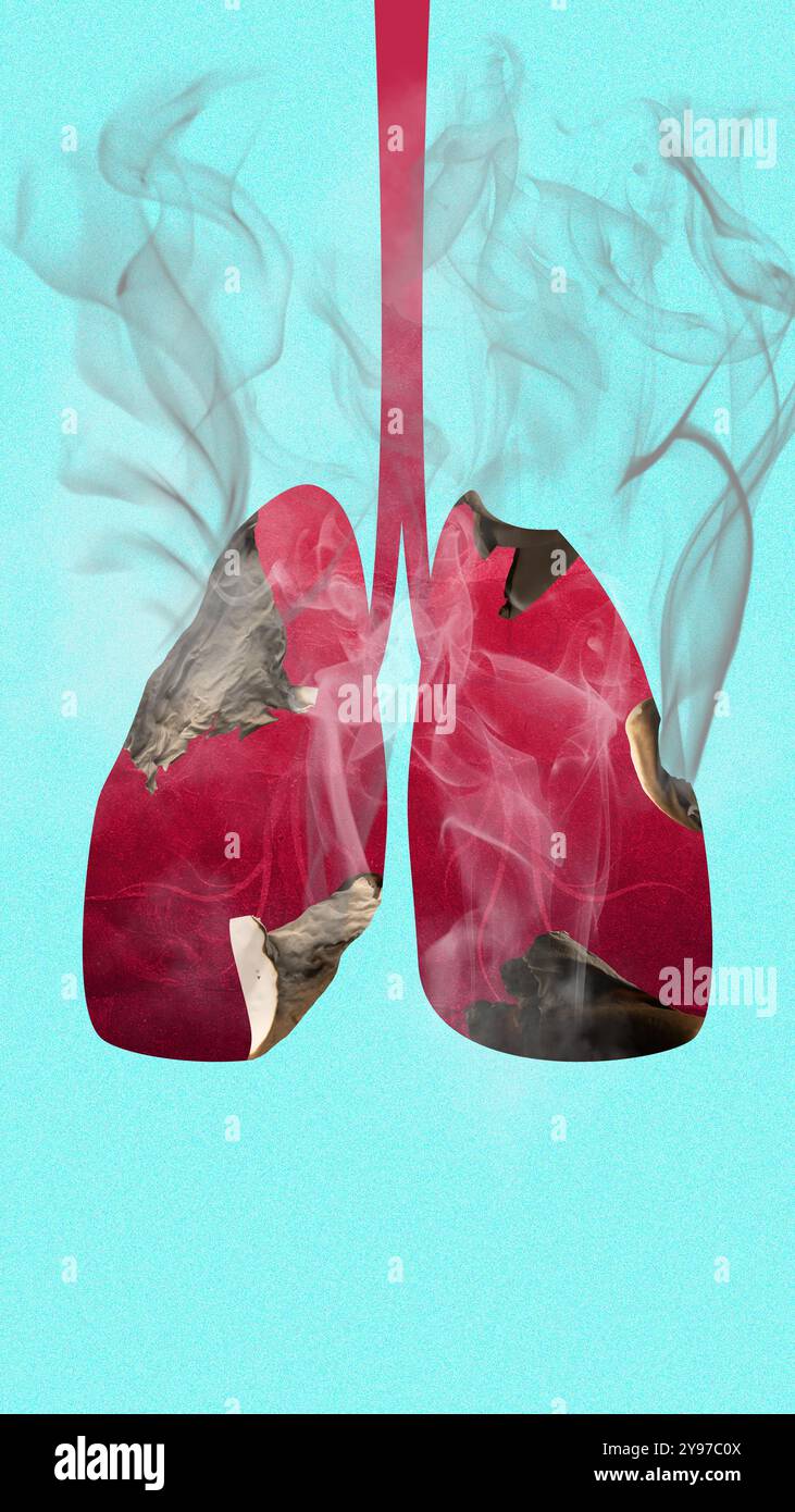 Give up smoking. Lungs scorched by smoke, indicating damage caused by ...
