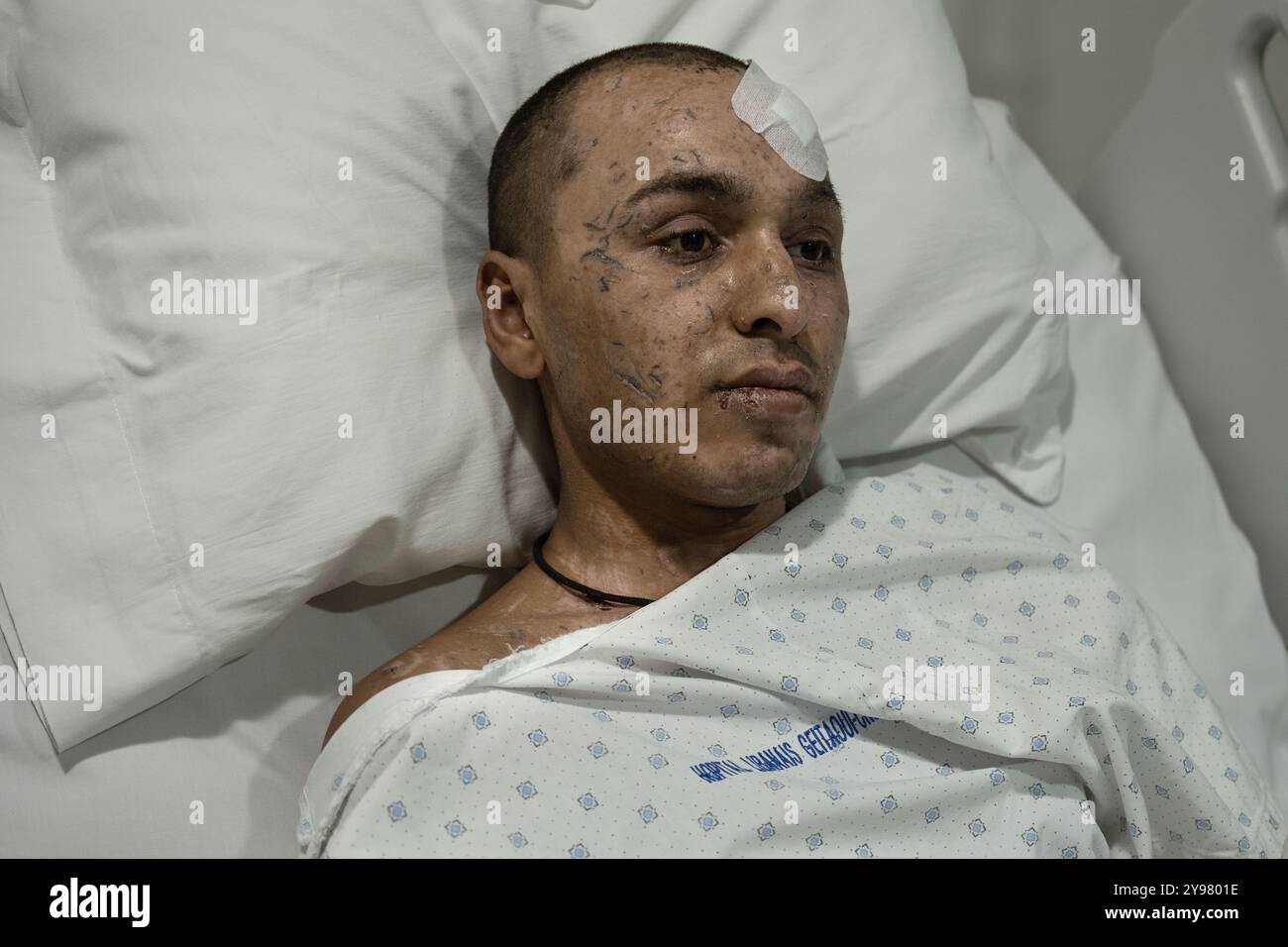 Burns unit hospital hi-res stock photography and images - Alamy