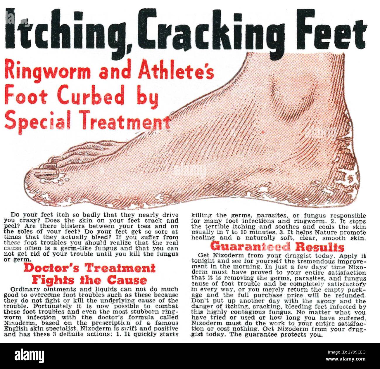 1937 Nixoderm intching, cracking feet treatment ad - "Ringworm and ...