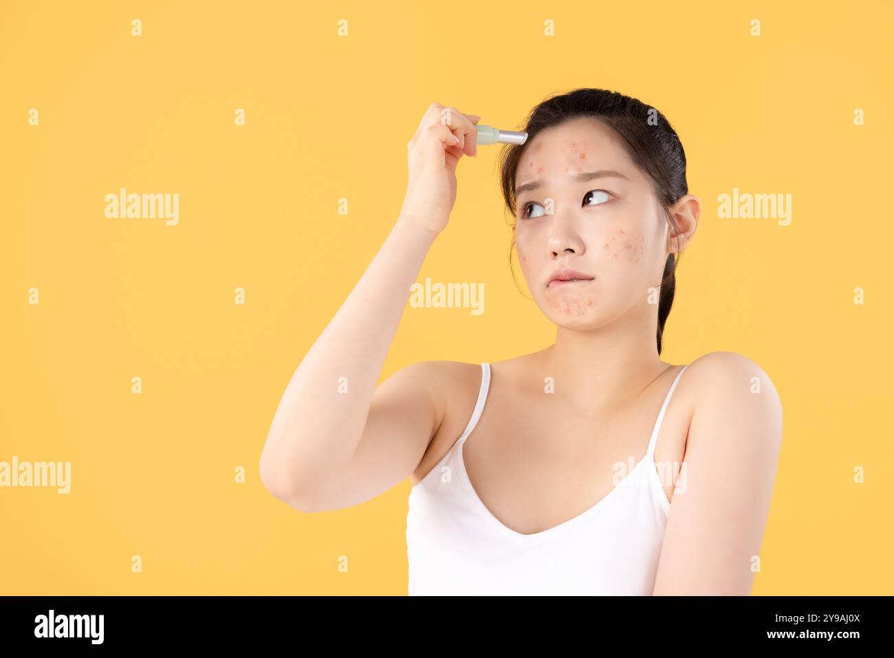 Teenage woman using ointment to remove skin problems on her face Stock ...