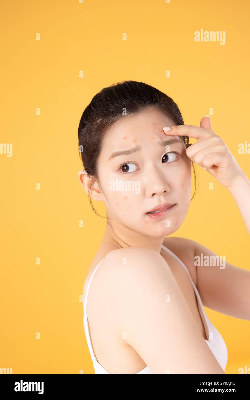 Teenage woman using ointment to remove skin problems on her face Stock ...