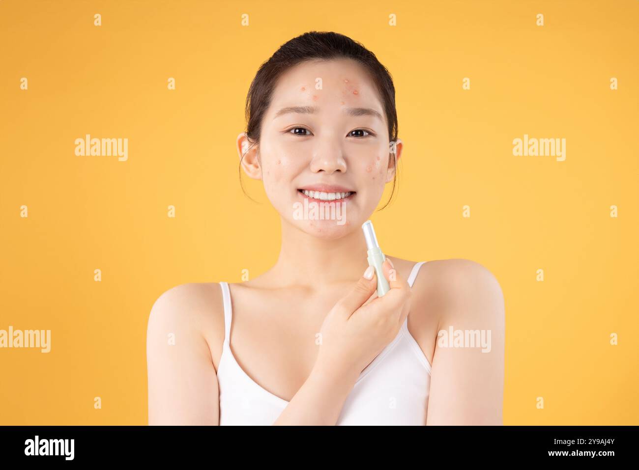 Teenage woman using ointment to remove skin problems on her face Stock ...