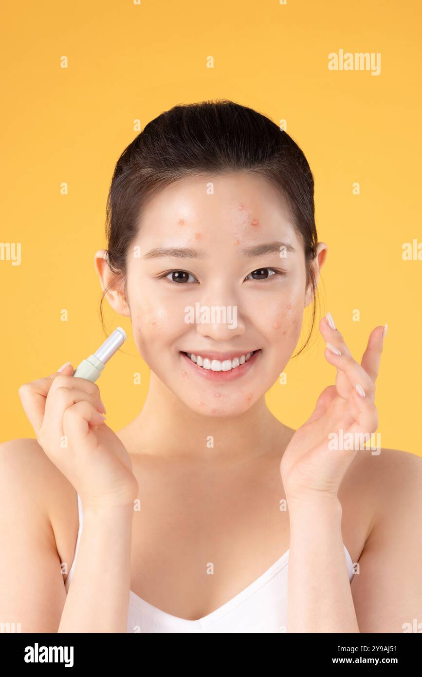 Teenage woman using ointment to remove skin problems on her face Stock ...