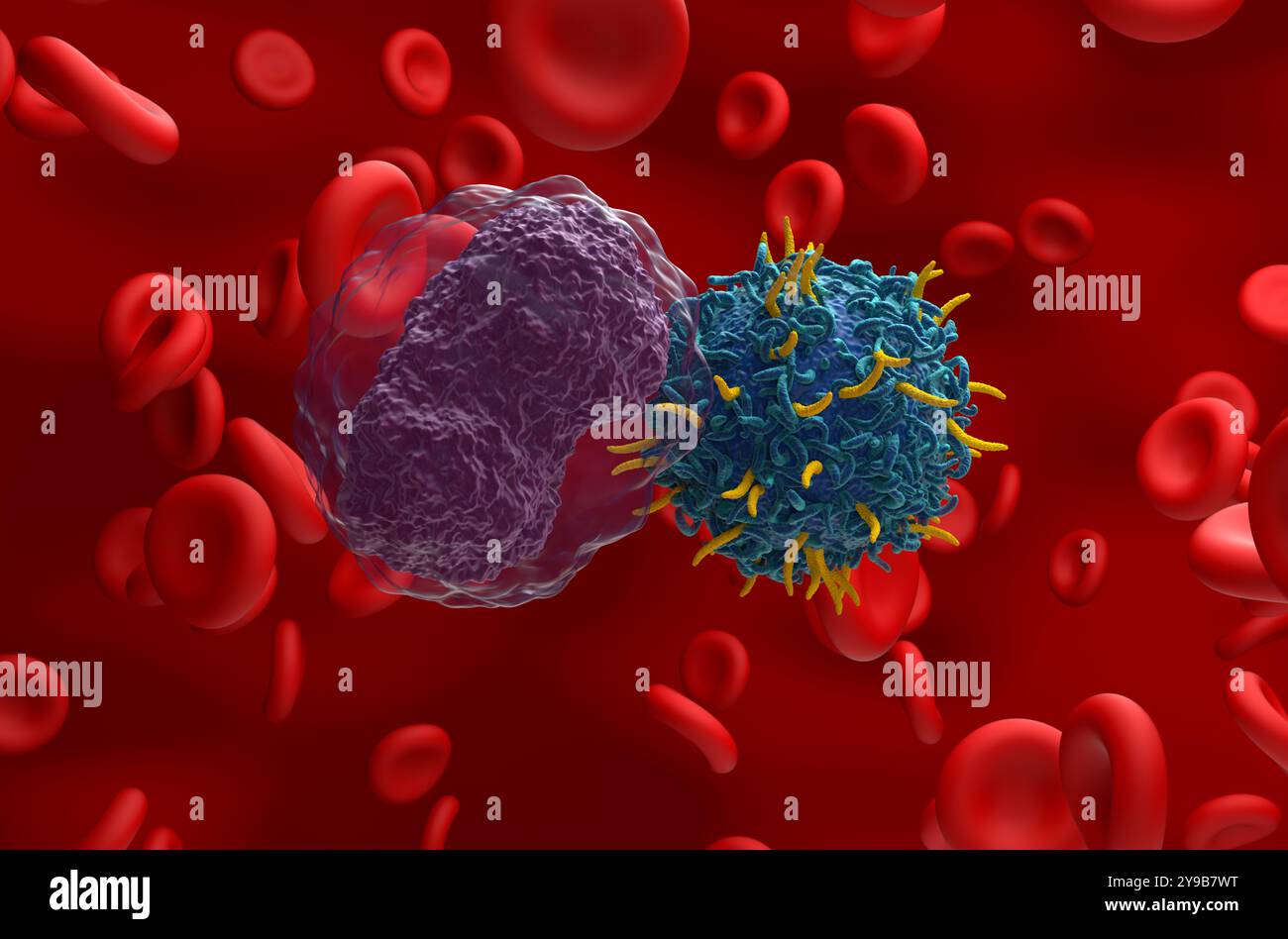 CAR T cell therapy in Non-hodgkin lymphoma (NHL) - closeup view 3d ...