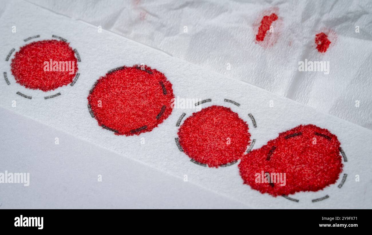 dry blood spots on a fiber filter for laboratory analysis, home health ...