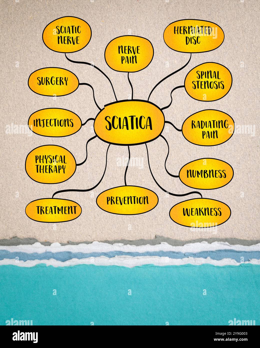 Sciatica refers to pain that radiates along the path of the sciatic ...