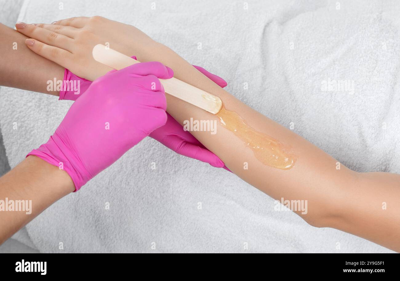 A beautician makes a sugar paste depilation of a woman's arms in a ...