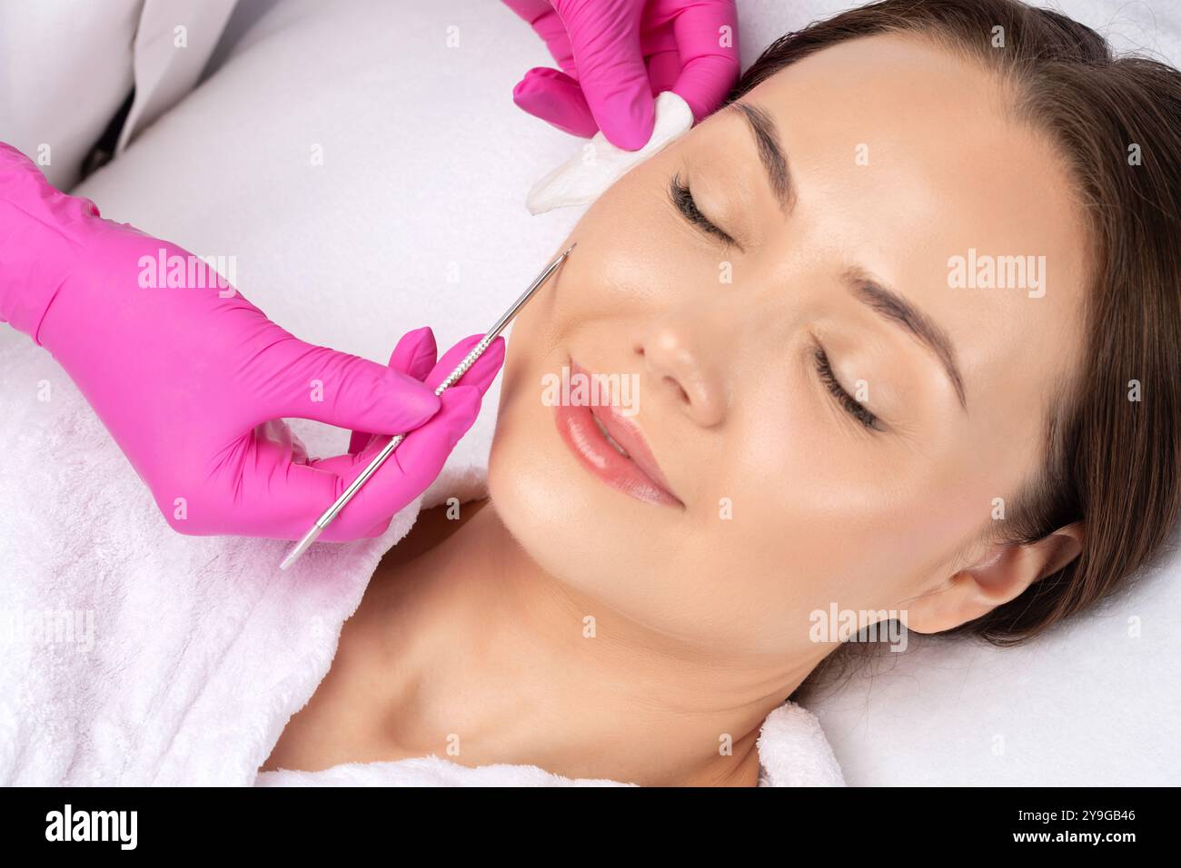 A procedure for cleansing the skin of the face from blackheads and acne ...
