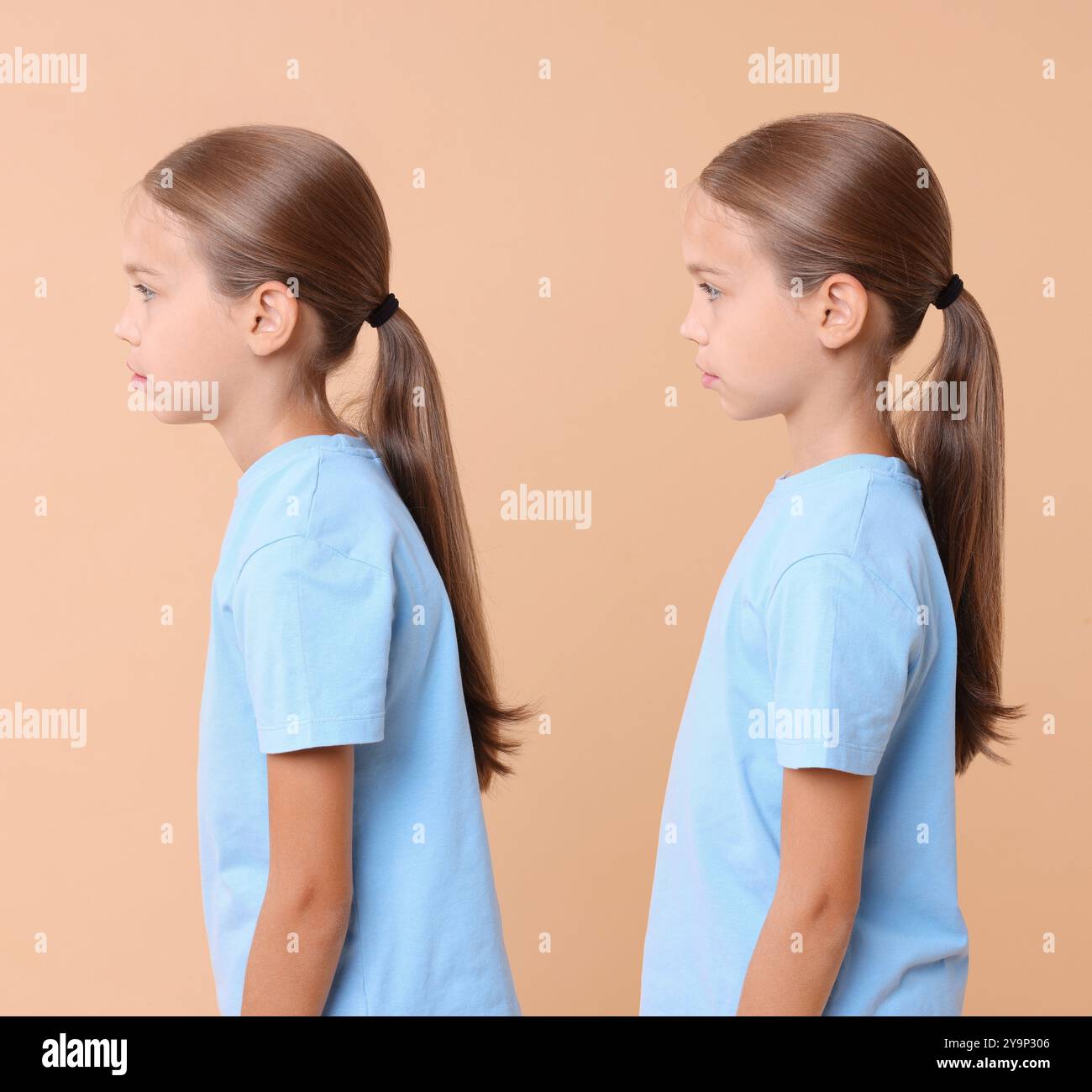 Good and bad posture, collage. Girl standing on dark beige background ...