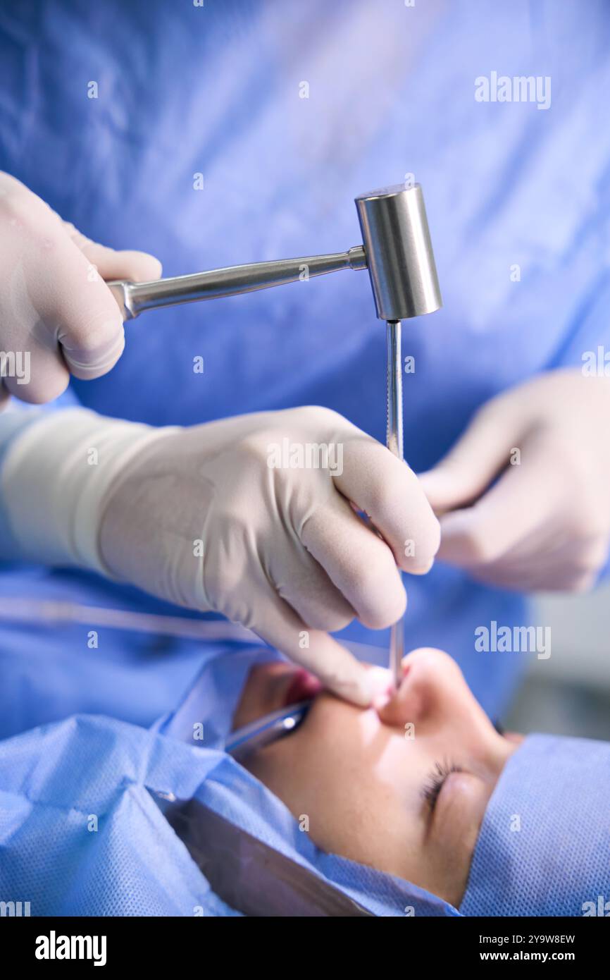 Patient undergoes a modern operation to straighten deviated nasal ...