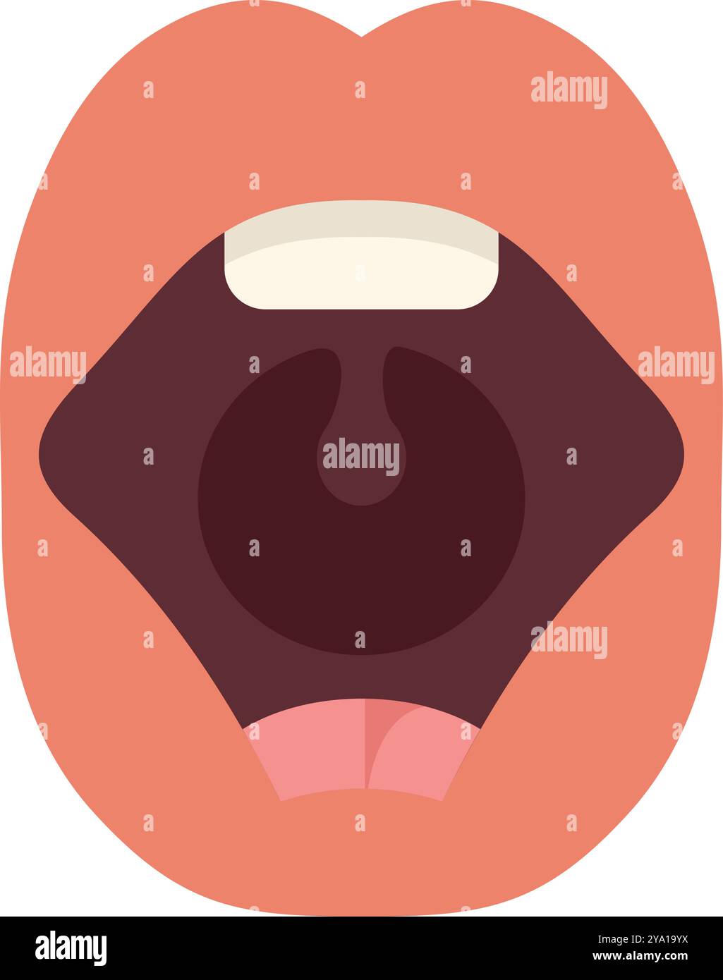 This illustration shows an open mouth with the tongue showing, teeth ...