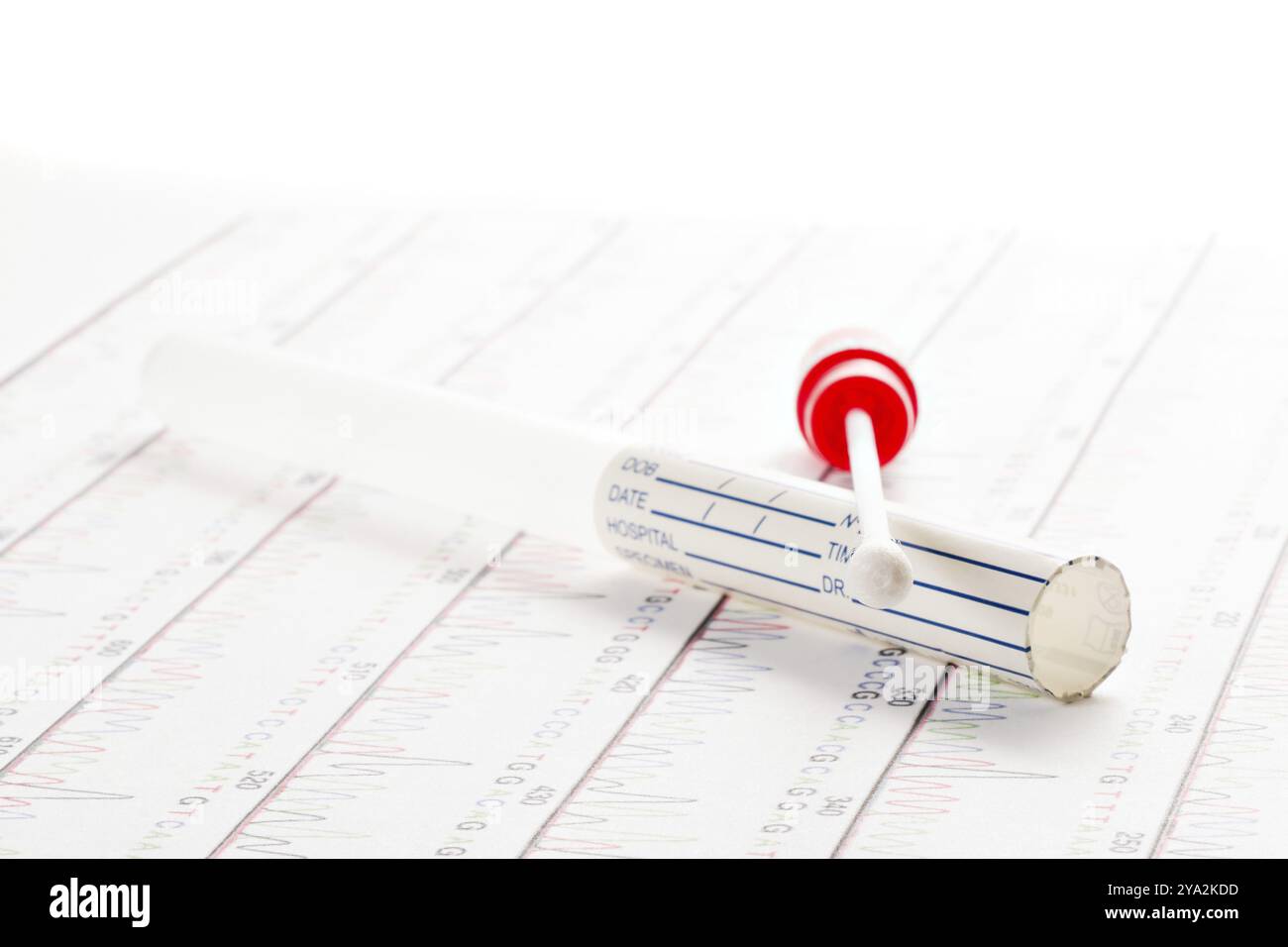 DNA test tubes and cotton swabs, wipe test Stock Photo - Alamy