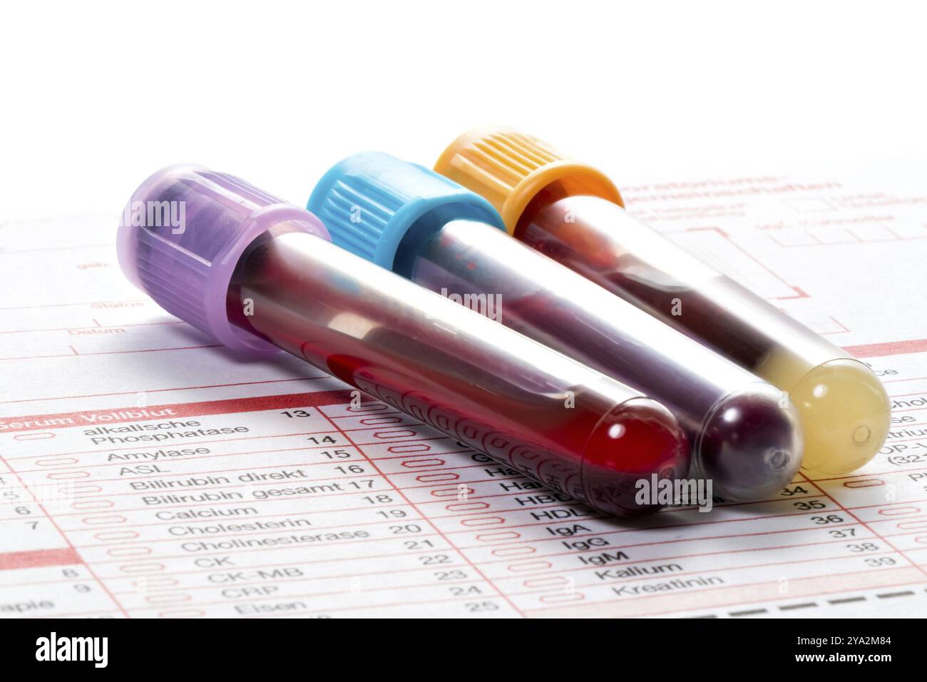 Blood samples are taken on a laboratory form to determine the blood ...