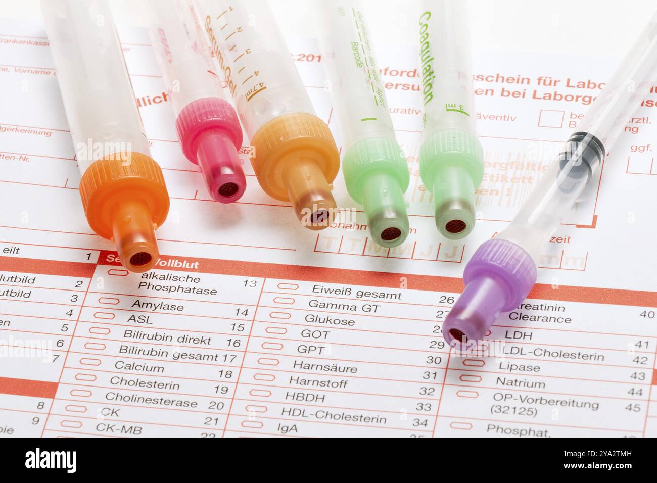 Blood samples are taken on a laboratory form to determine the blood ...