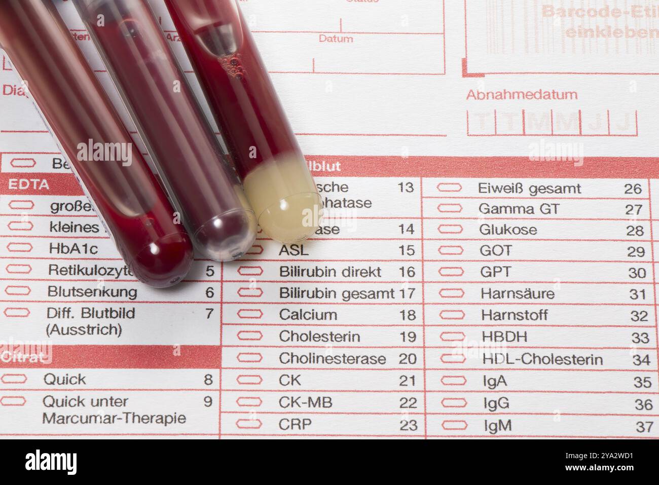 Blood samples are taken on a laboratory form to determine the blood ...