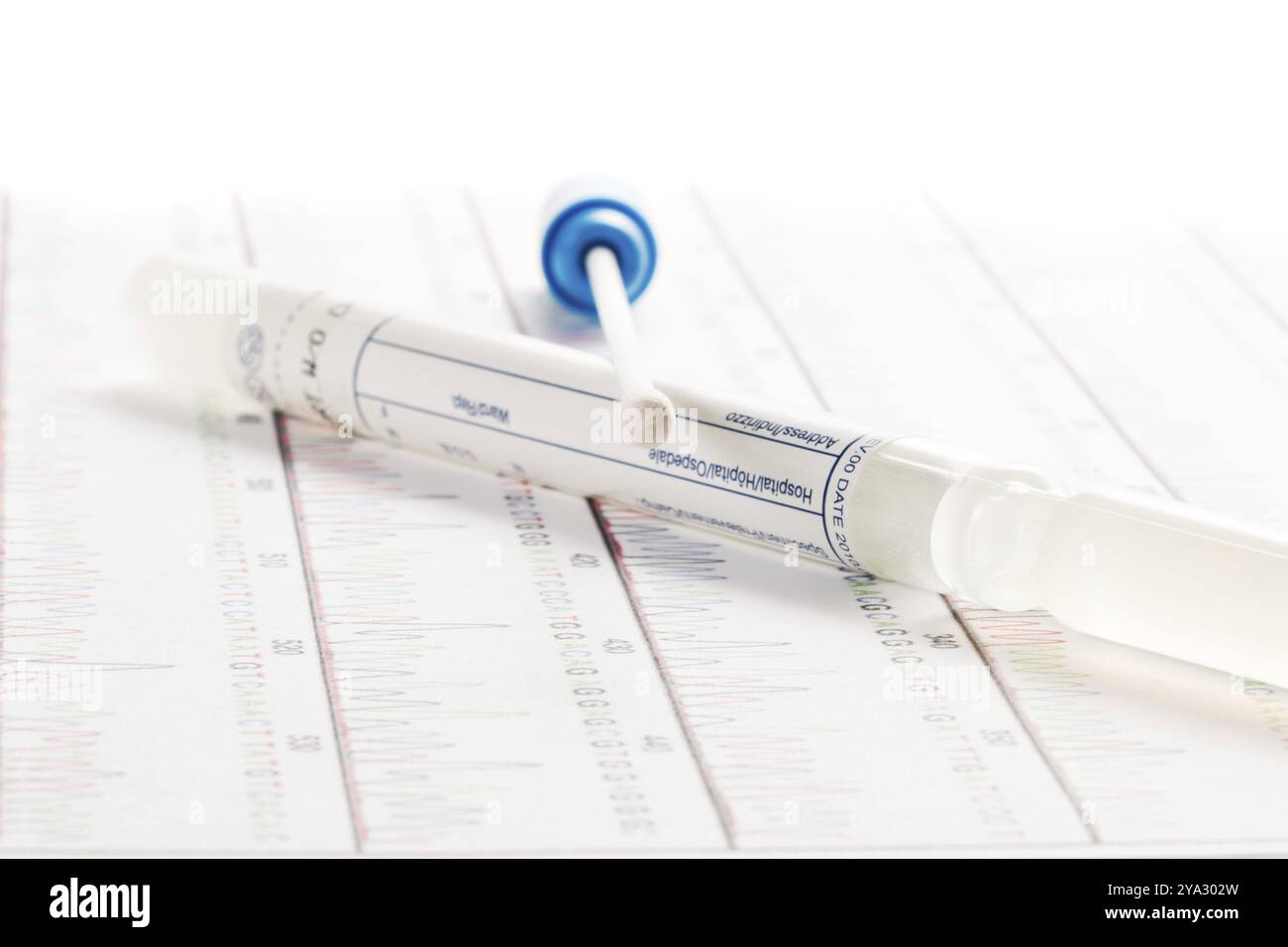 DNA test tubes and cotton swabs, wipe test Stock Photo - Alamy