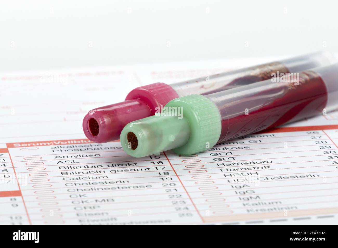 Blood samples are taken on a laboratory form to determine the blood ...