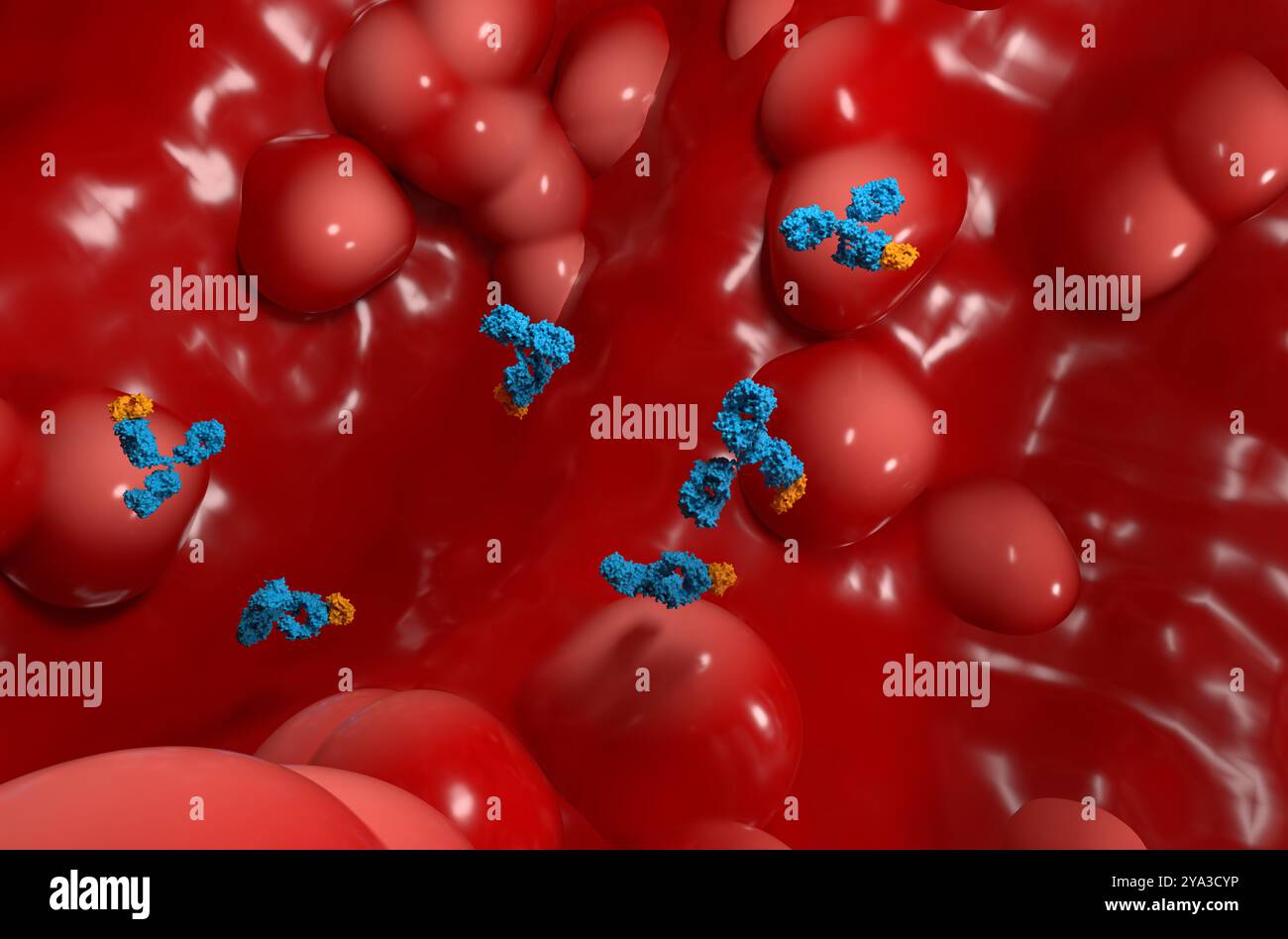 Monoclonal antibody treatment in Ulcerative colitis (UC) - closeup view ...
