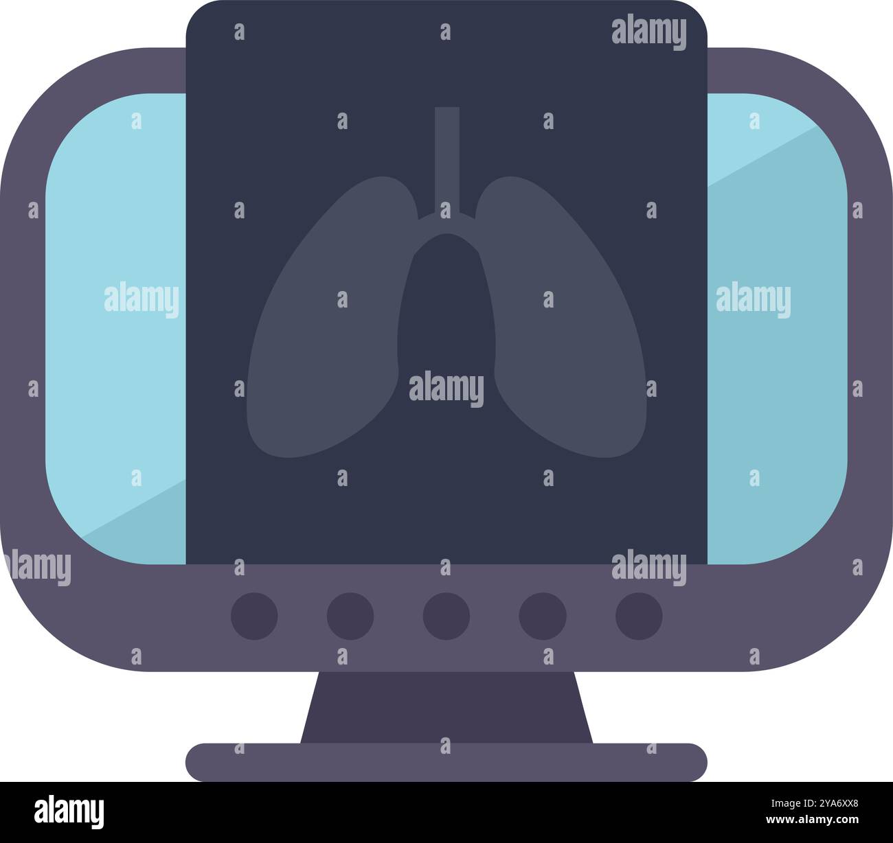 Computer displaying lungs x ray on screen, concept for online medical ...