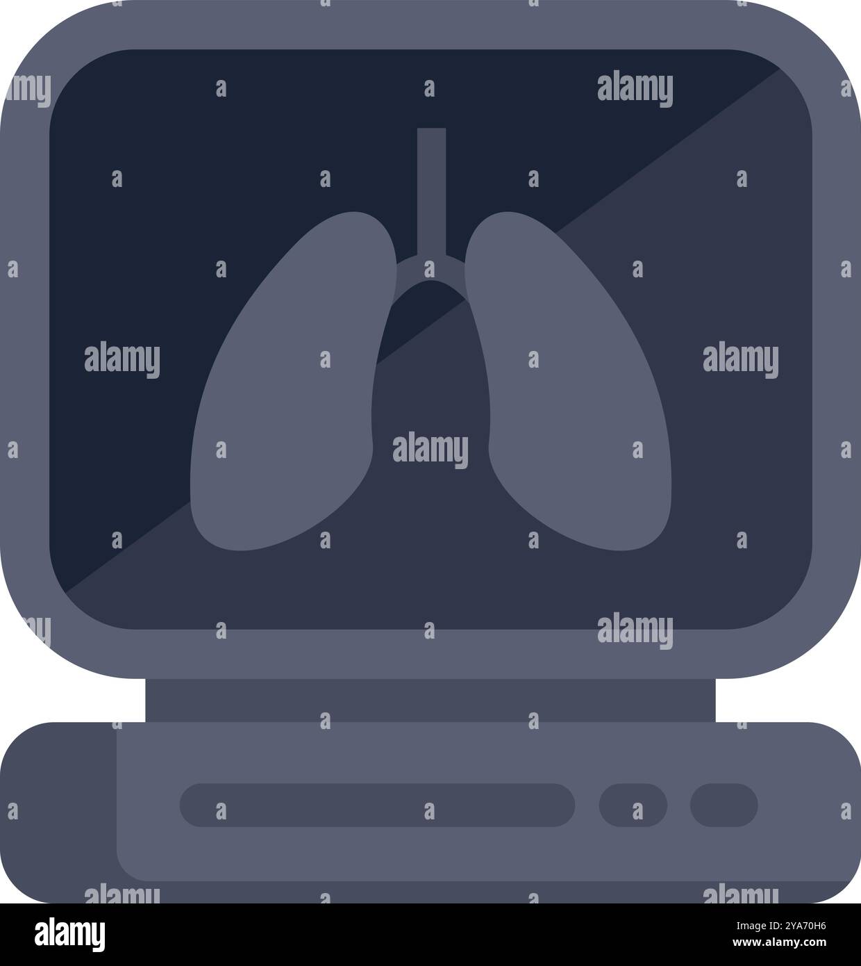 X ray machine displaying a scan of healthy human lungs on its monitor ...