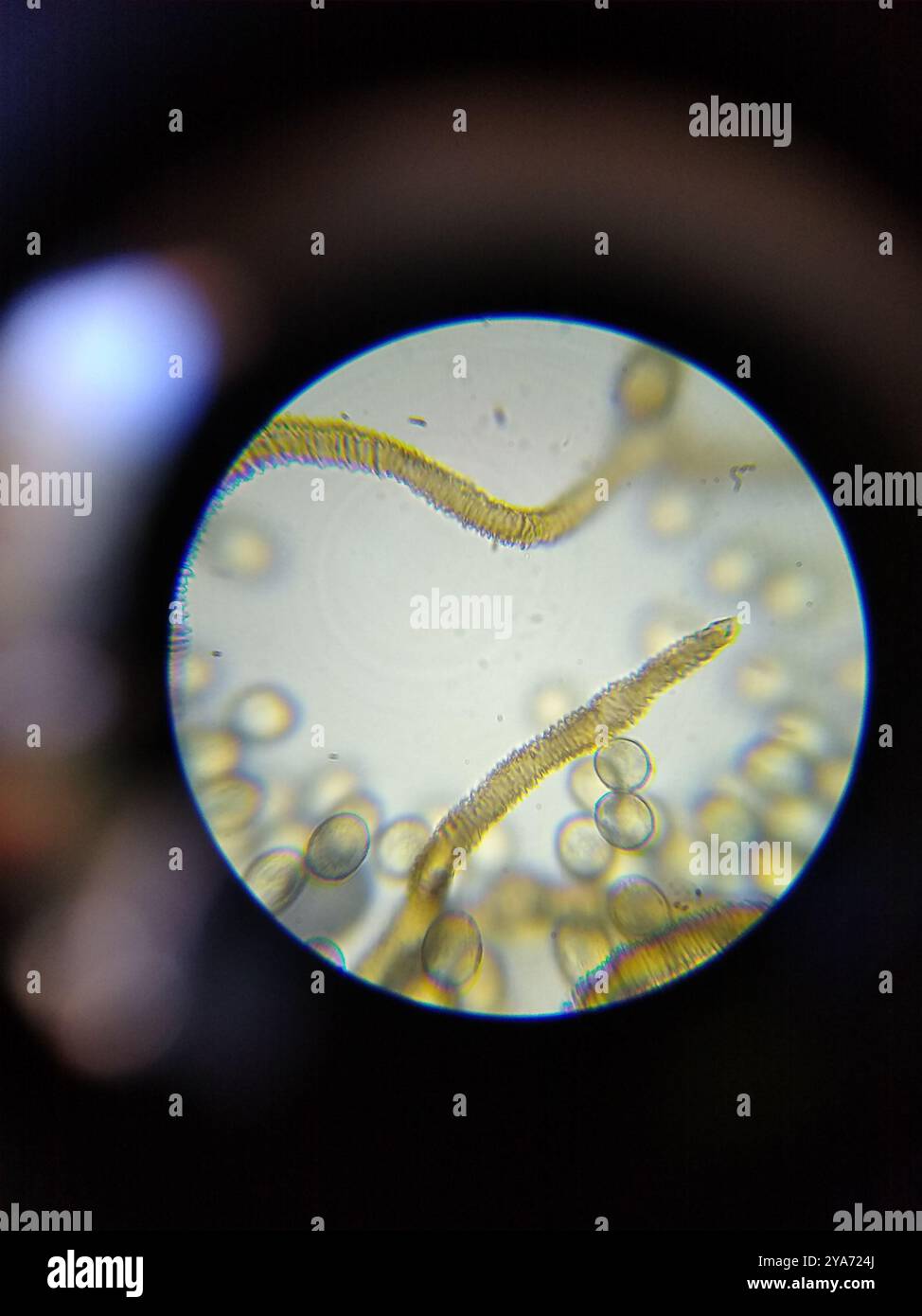 (Arcyria olivaceoglobosa) Protozoa Stock Photo - Alamy