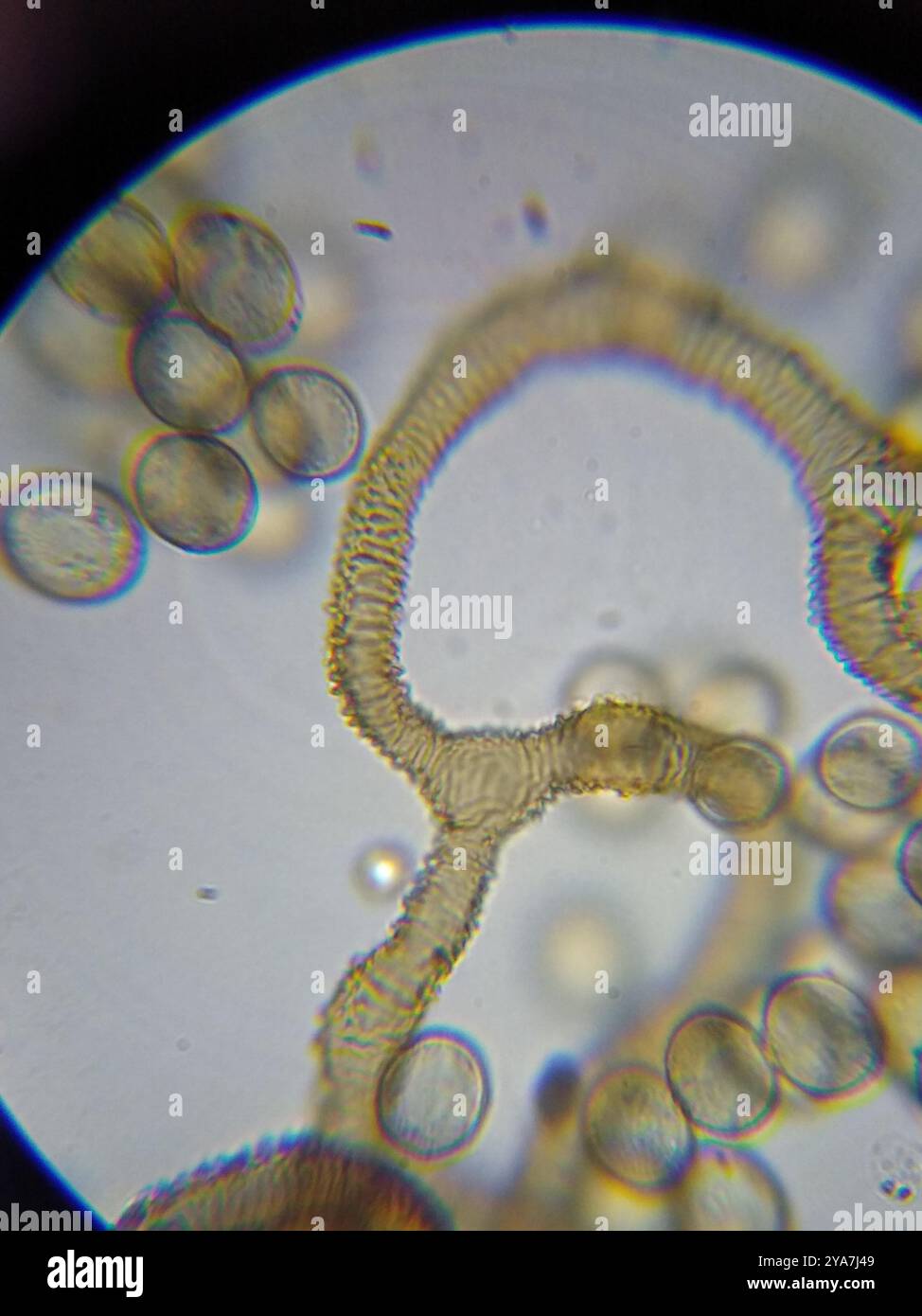 (Arcyria olivaceoglobosa) Protozoa Stock Photo - Alamy