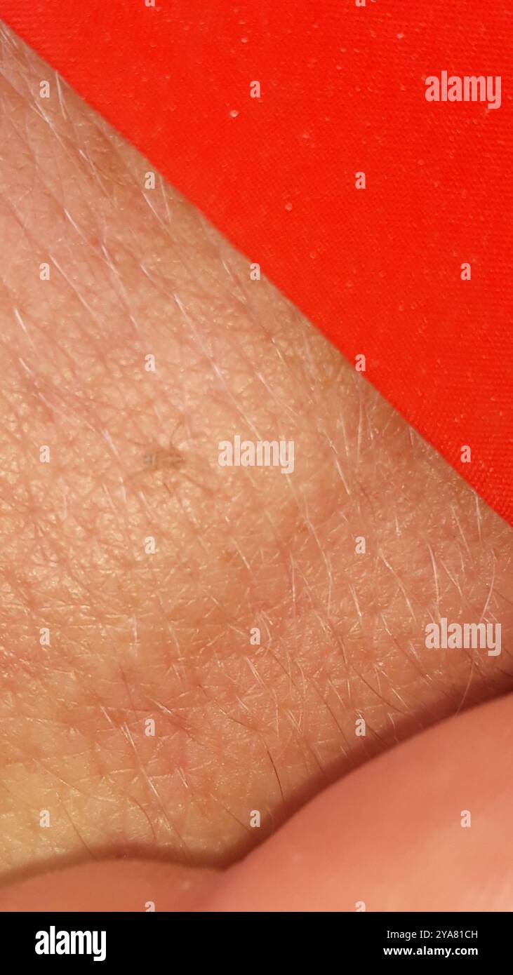 Common Spitting Spider (Scytodes thoracica) Arachnida Stock Photo - Alamy