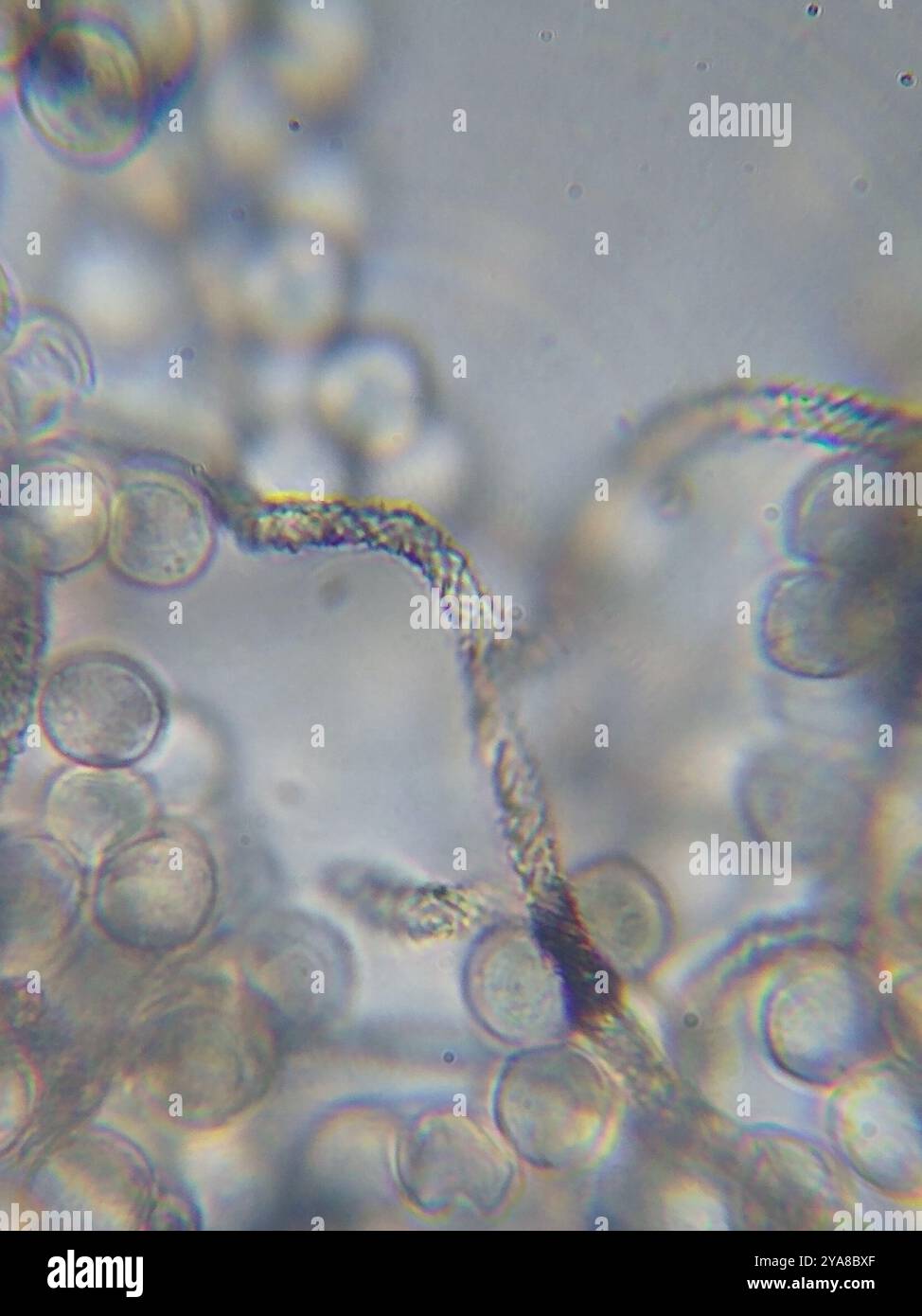 (Arcyria riparia) Protozoa Stock Photo - Alamy