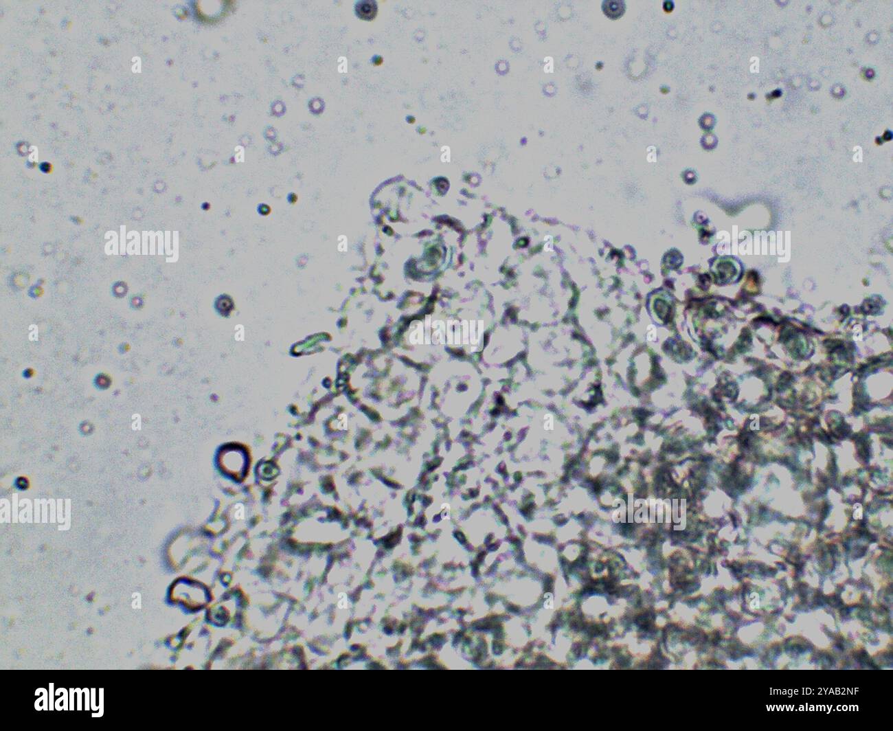 Snapping bonnet hi-res stock photography and images - Alamy