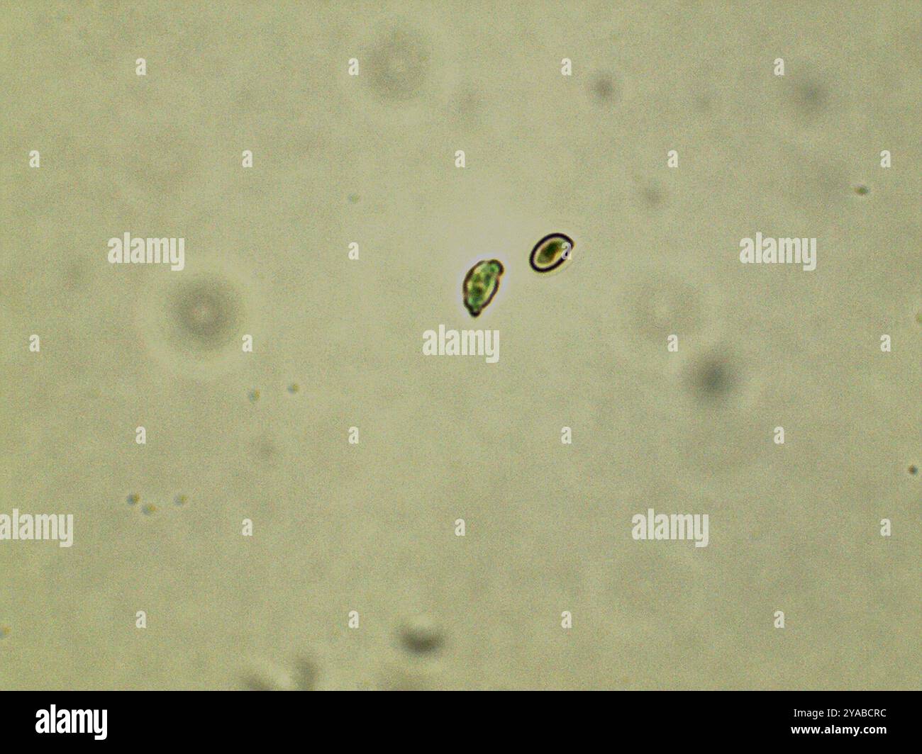 Snapping bonnet hi-res stock photography and images - Alamy