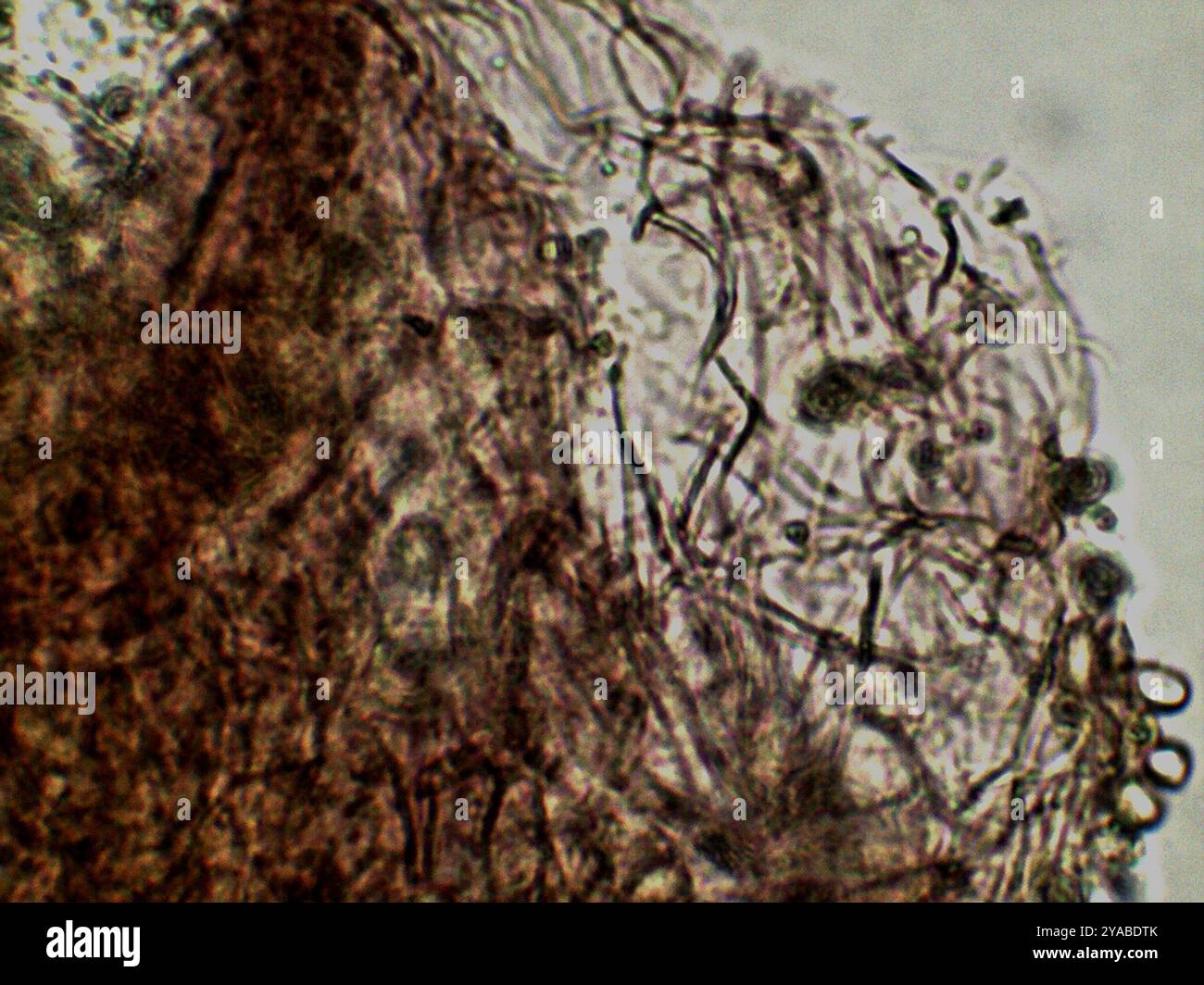 Snapping bonnet hi-res stock photography and images - Alamy