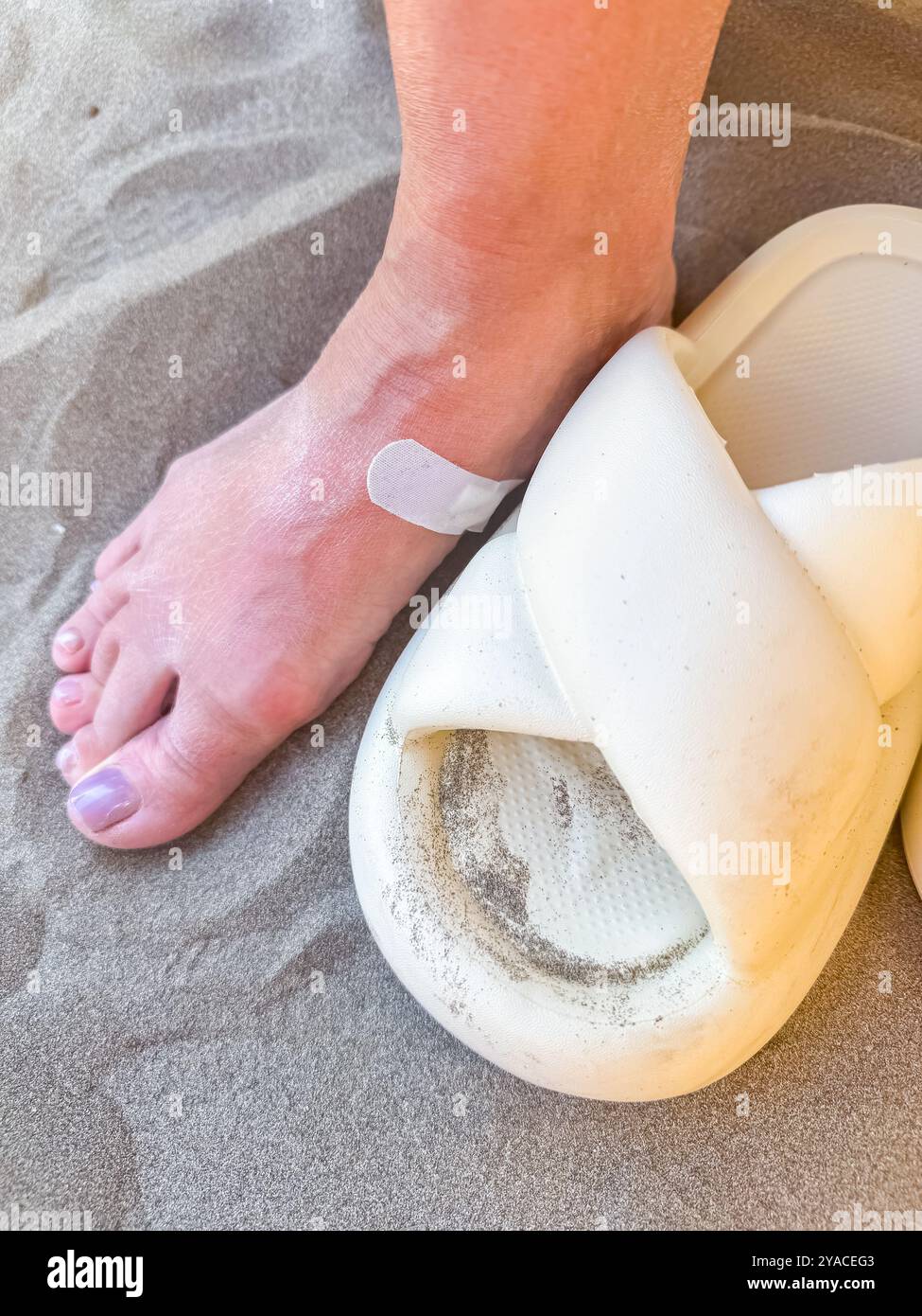 Senior woman foot with injury plaster, resting on sand beside a white ...