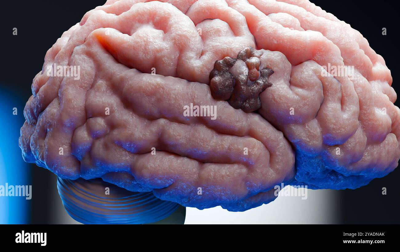 Human brain nervous system anatomy, neural cancer, Sebaceous bulb ...