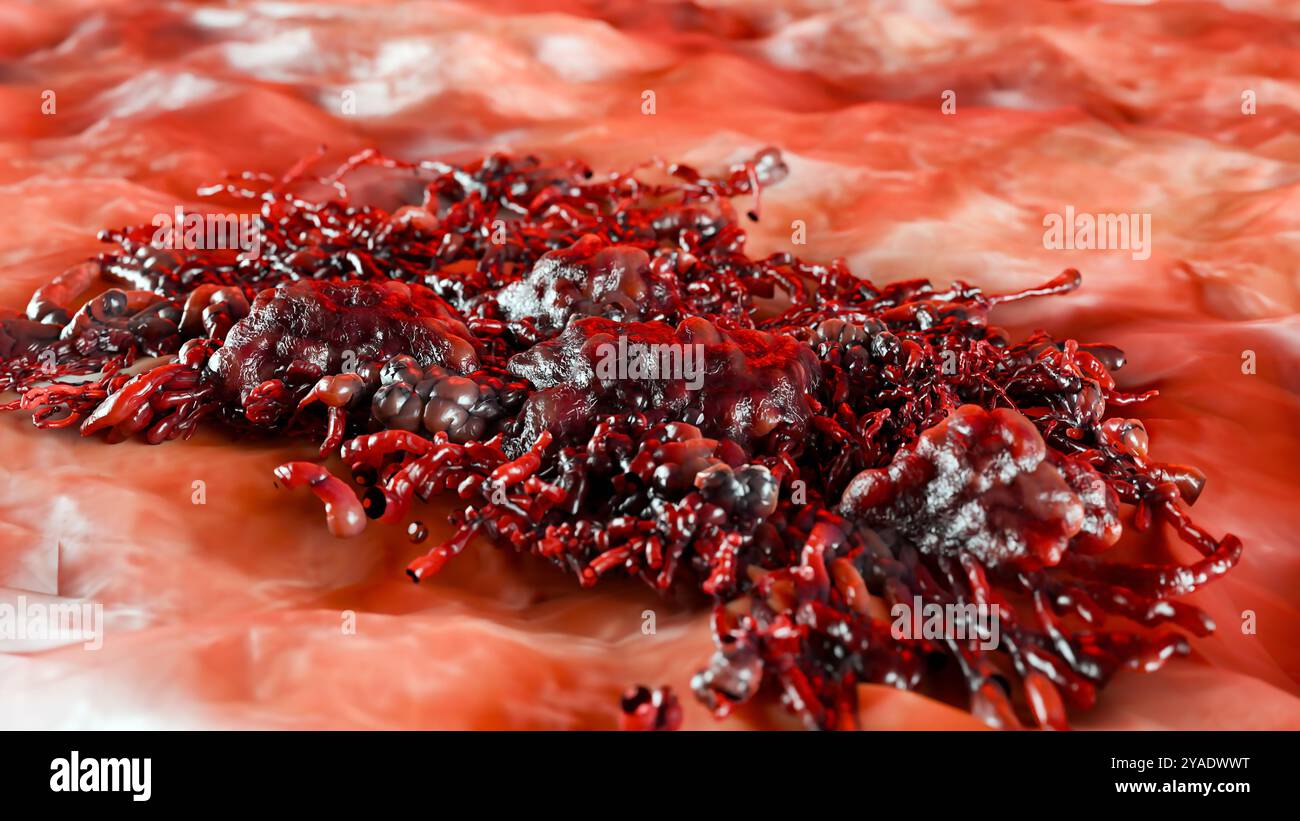 Cancer cell growth uncontrollably over tissue, Tumor infection cells ...