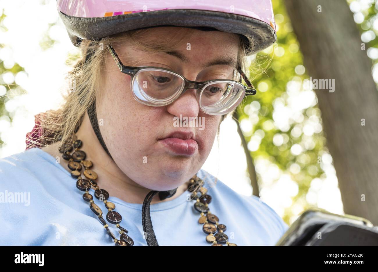 Portrait of a 39 year old white woman with Down Syndrome, calling her ...