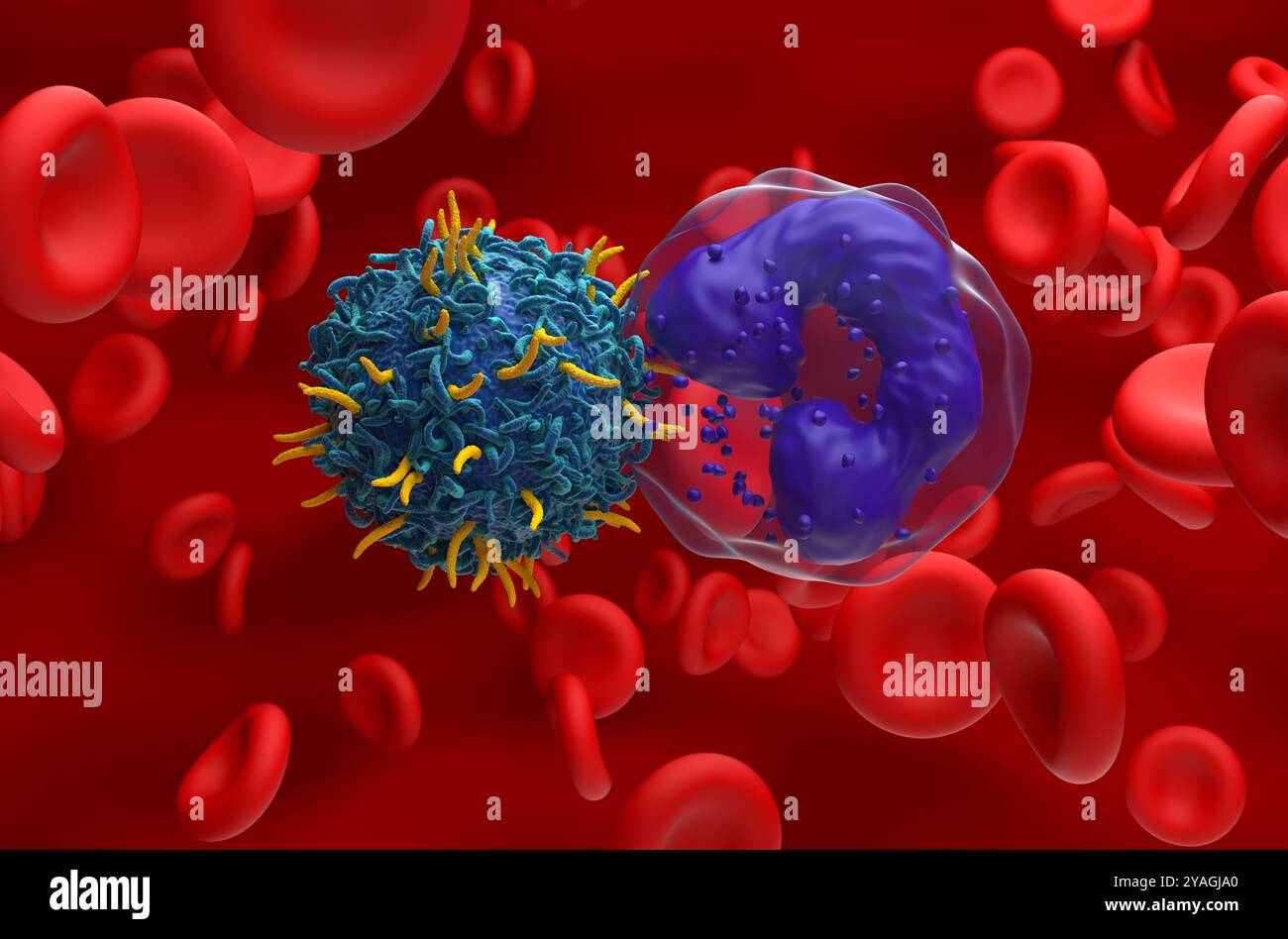 CAR T cell therapy in Chronic Myelogenous Leukemia (CML) - closeup view ...