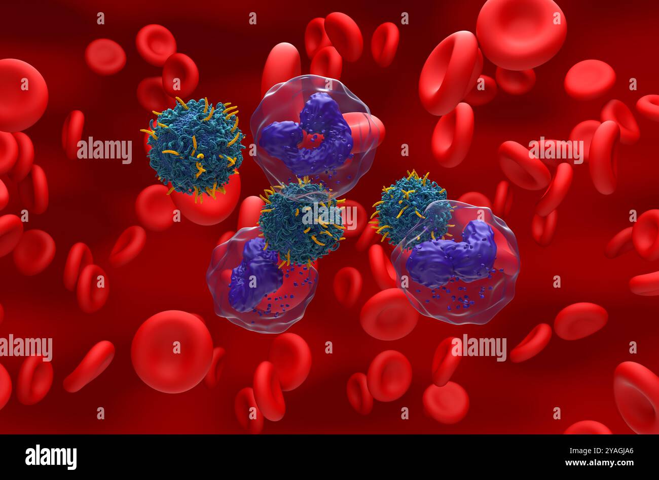 CAR T cell therapy in Chronic Myelogenous Leukemia (CML) - isometric ...