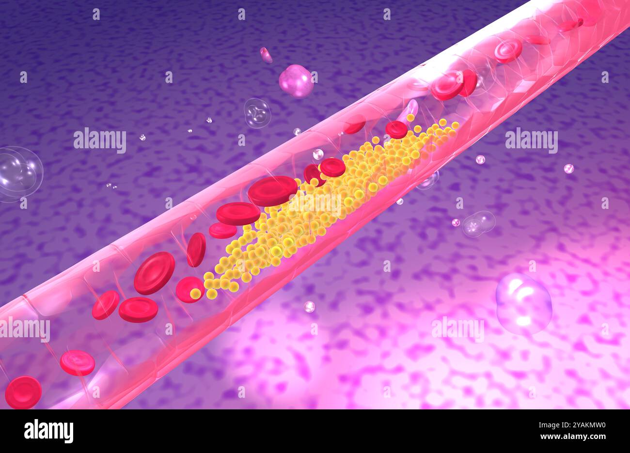 Anatomical 3d illustration of the interior of an artery with the ...