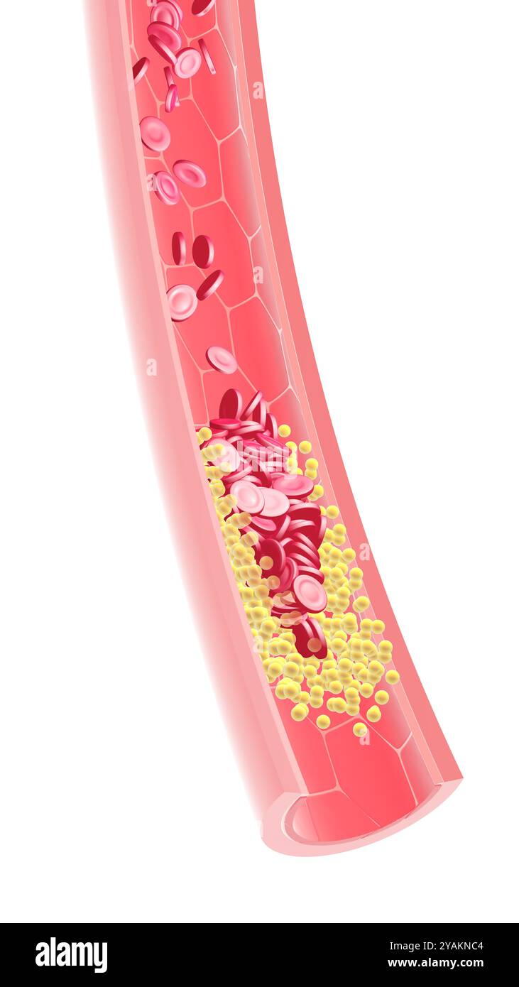 Anatomical vertical 3D illustration of the interior of an artery ...