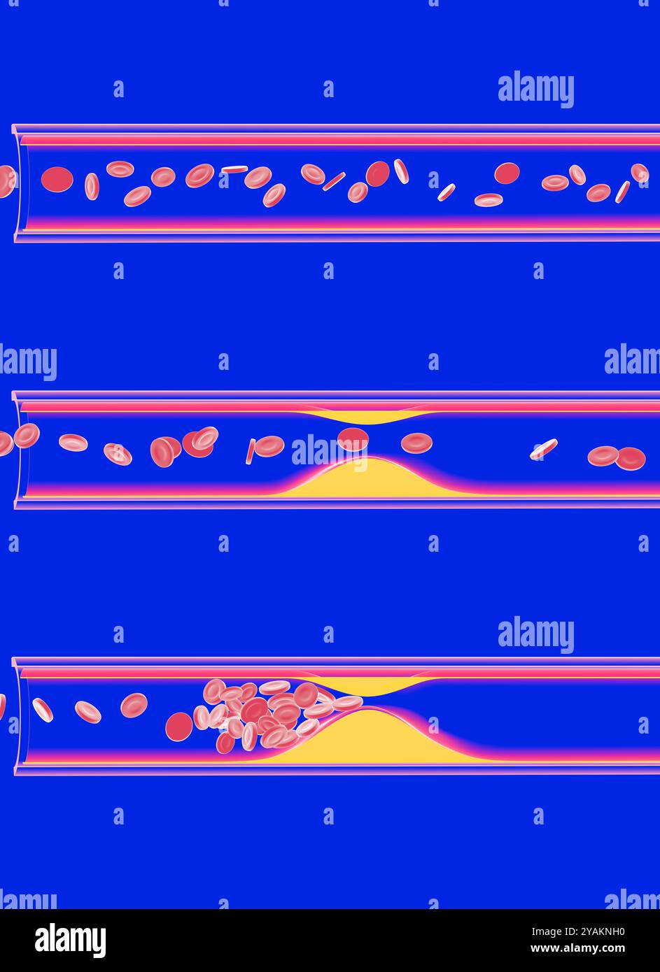 3D illustration of the interior of a transparent glass artery ...