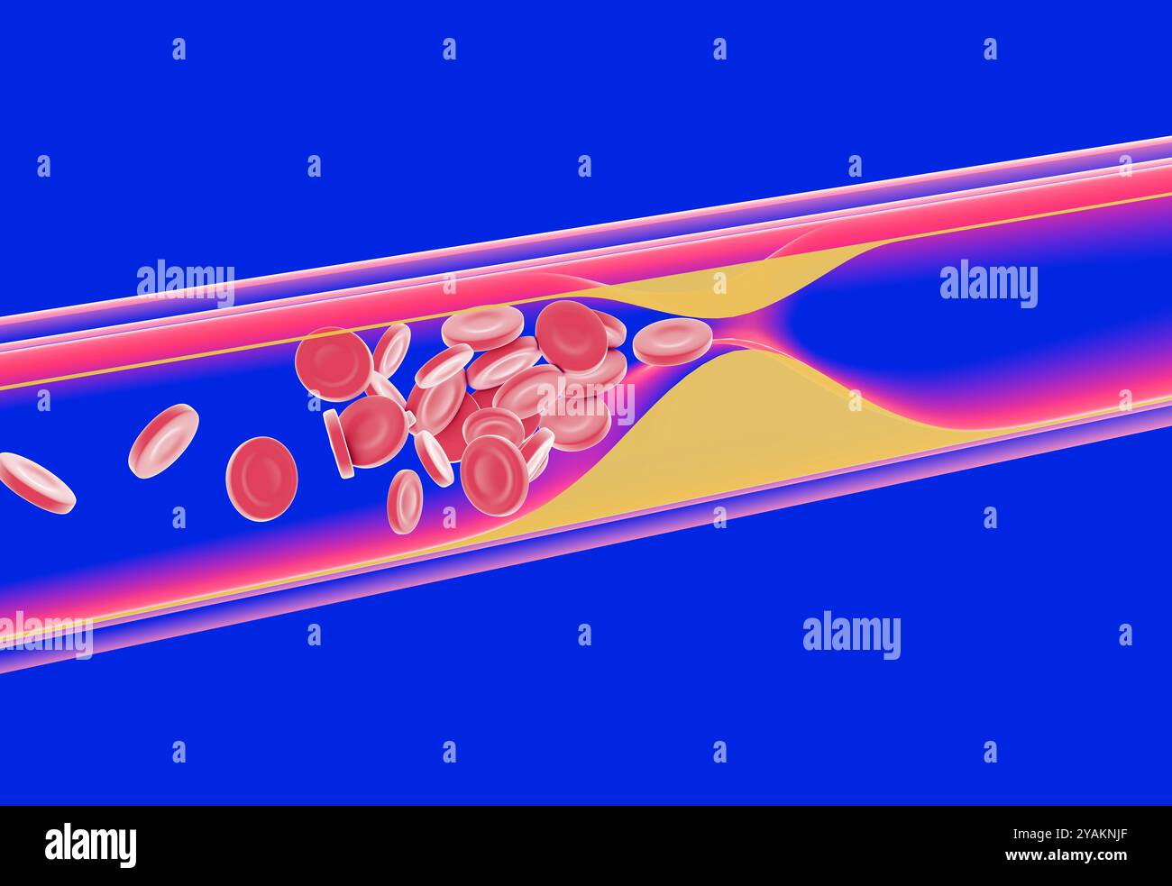 3D illustration of the interior of a transparent glass artery with the ...