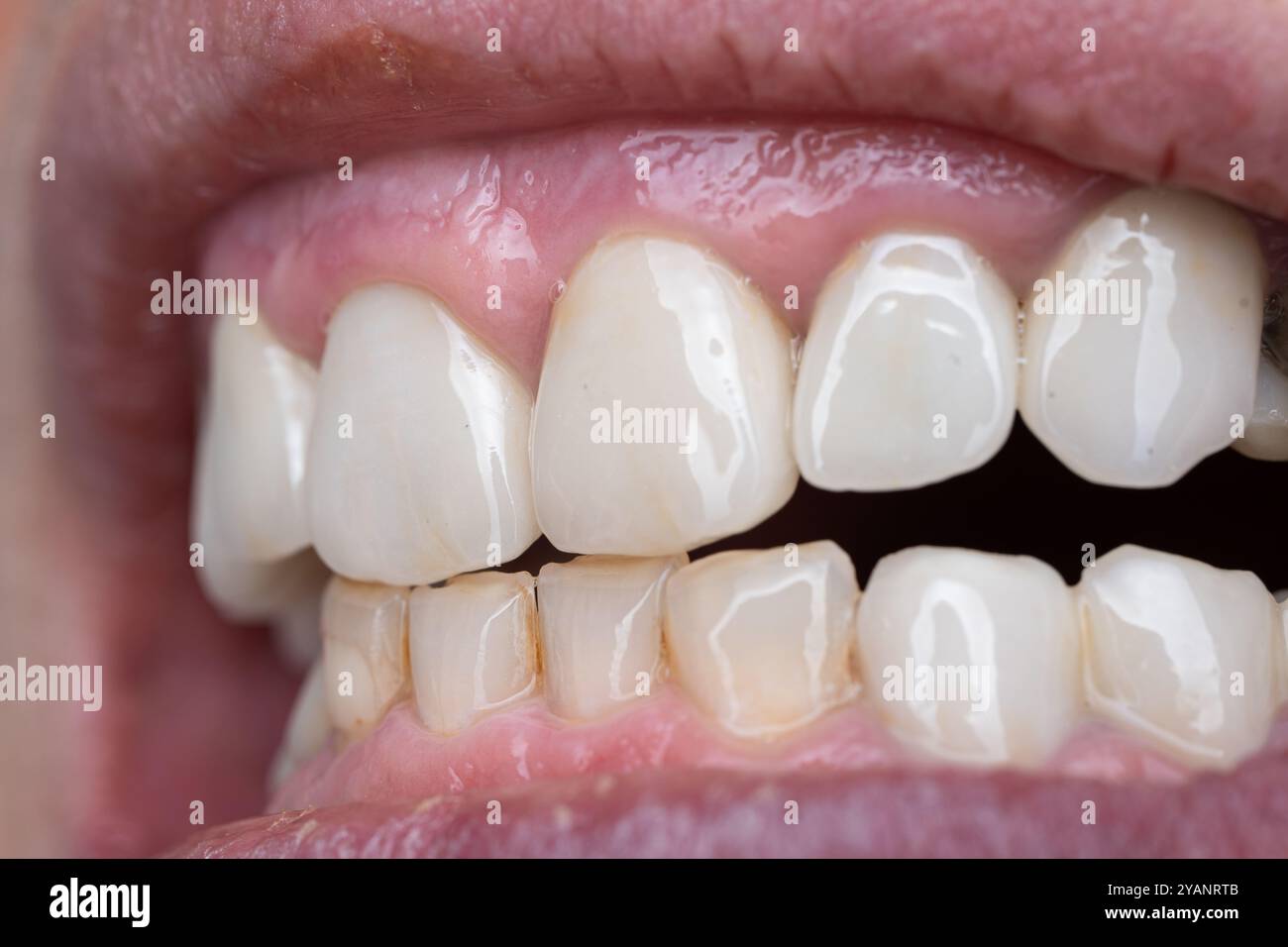Dental clinic concept closeup shot hi-res stock photography and images ...