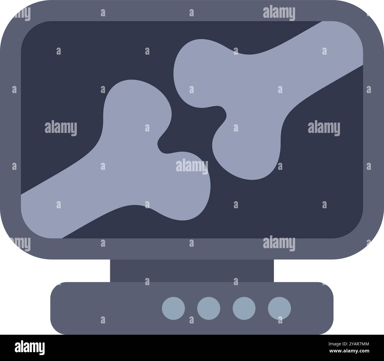 Medical monitor is displaying an x ray image of bones, highlighting the ...